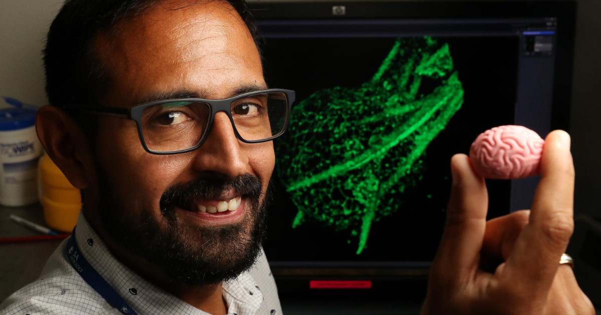 - Cure Brain Cancer Foundation